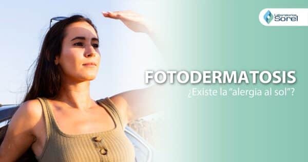 ¿Qué Es La Fotodermatosis? ¿Existe La “alergia Al Sol”?